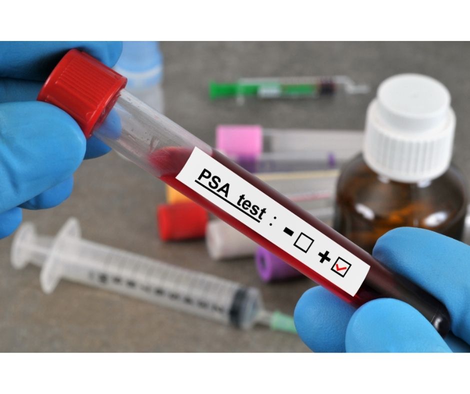 How Has Prostate Cancer Screening Changed? - DirectMed DPC – Affordable ...